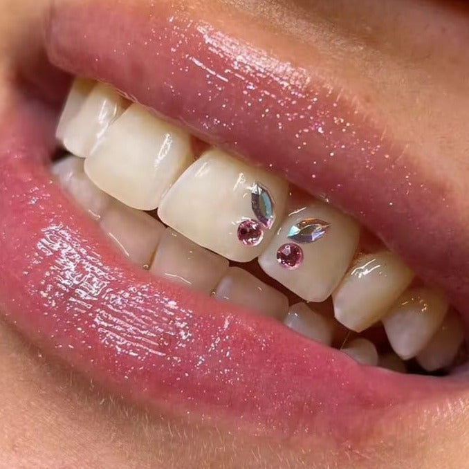 Butterfly Tooth Gem Set – Felmore